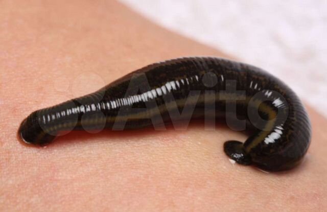 Пиявки медицинские